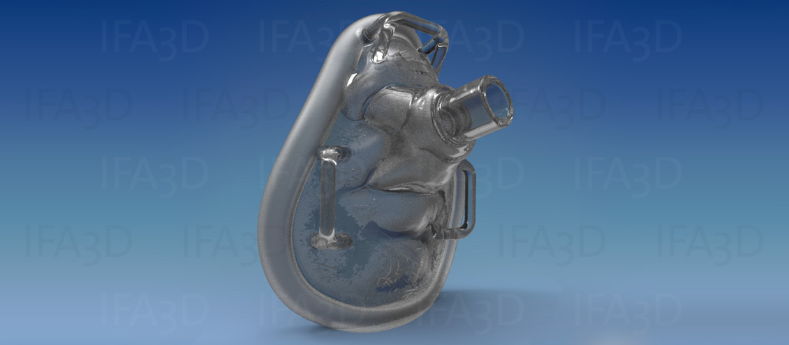 IFA3D Medical Solutions GmbH – IFA3D